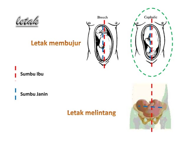 Partus Lama final | PDF