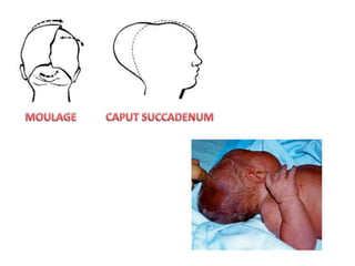 Partus Lama final | PDF