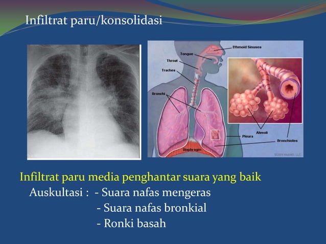 Pengantar pemeriksaan fisik pada paru.pdf