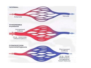 parvati- hemo- final.pptx