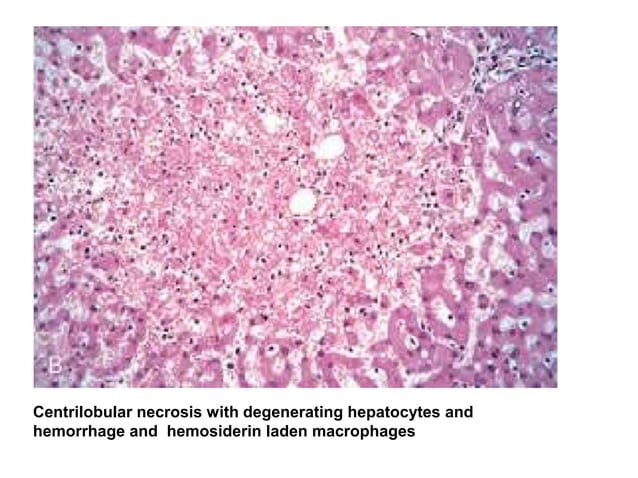 parvati- hemo- final.pptx