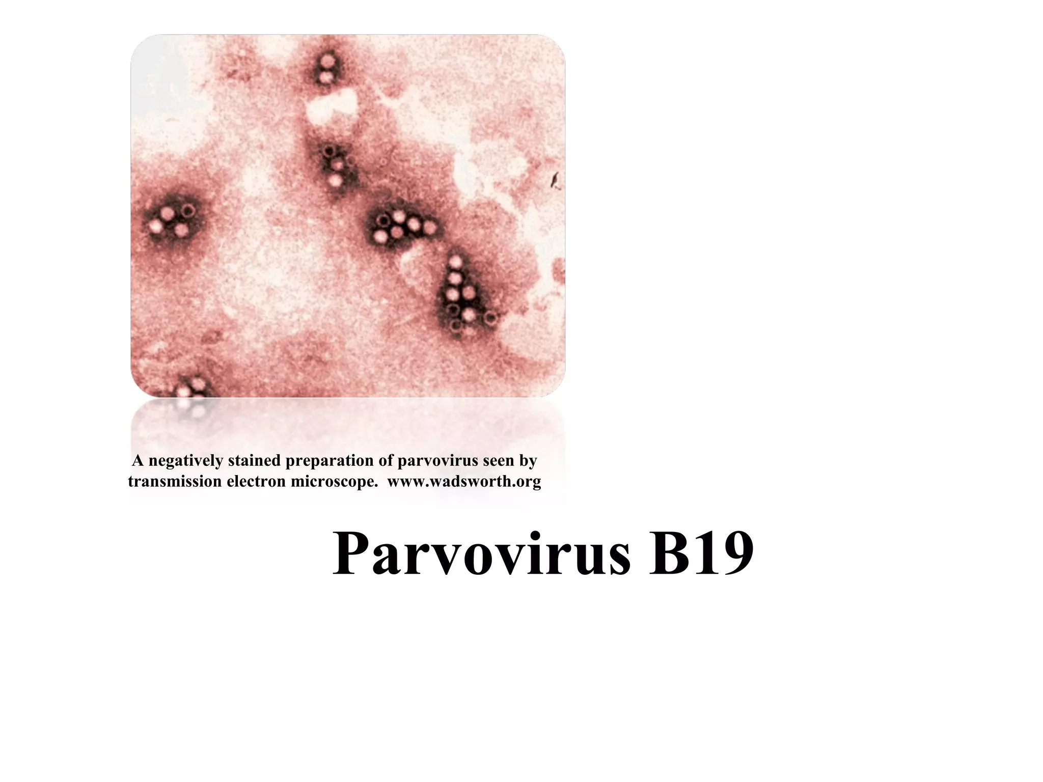 Parvovirus b19 | PPT