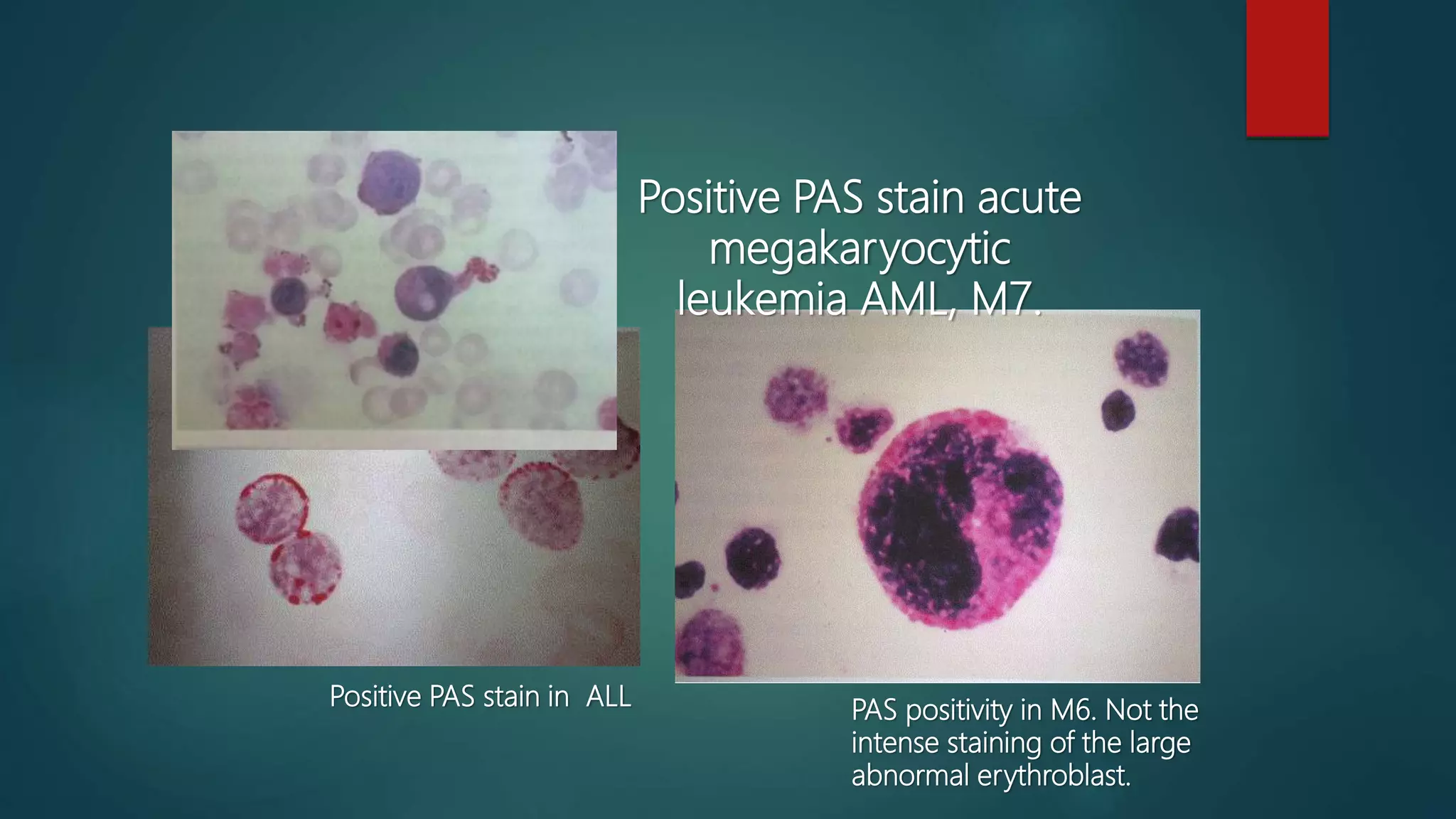 Pas staining | PPTX