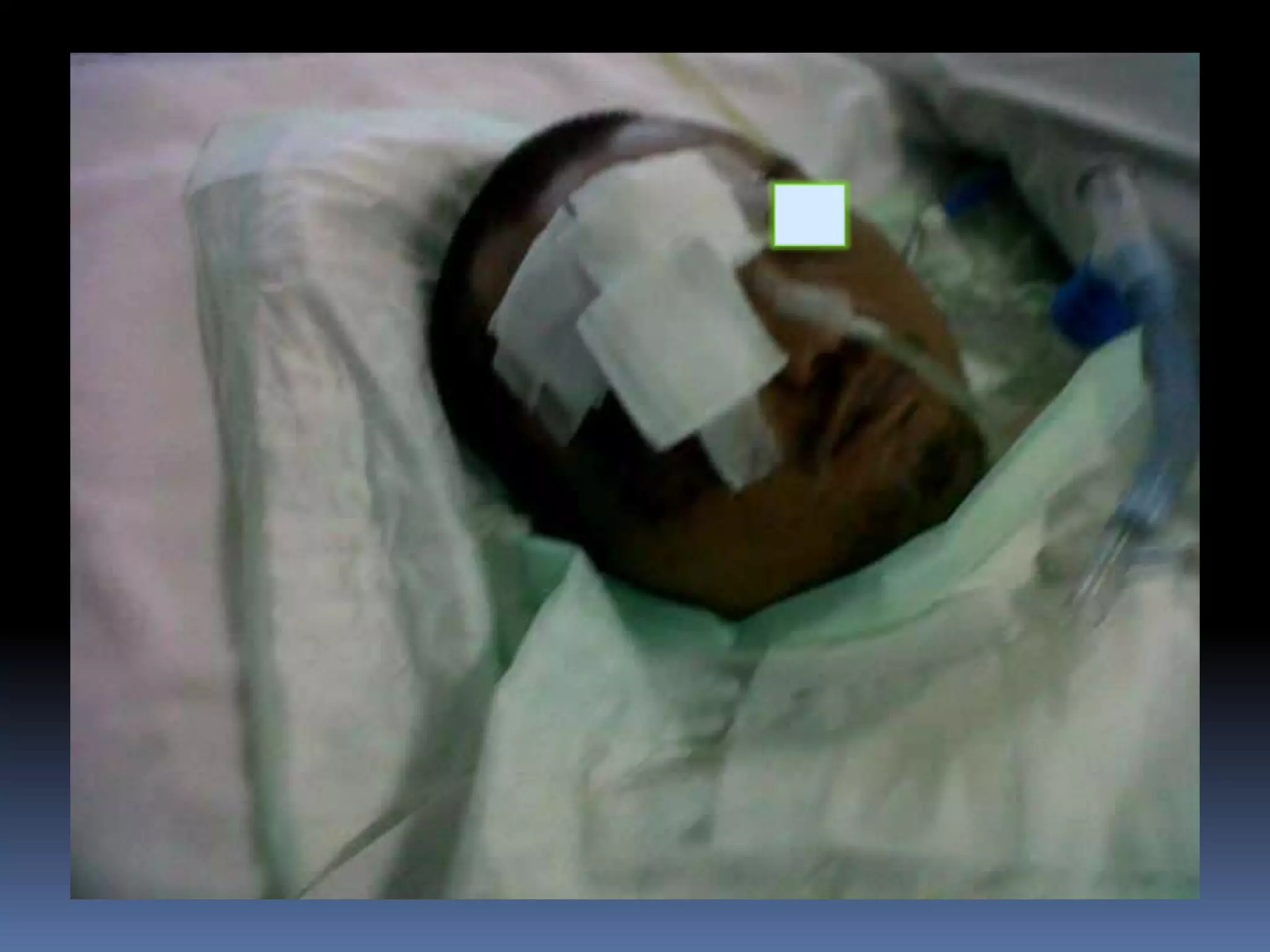 Heavy Trauma Patient | PPT