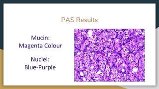 Periodic Acid Schiff and Alcian Blue Periodic Acid Schiff | PPTX
