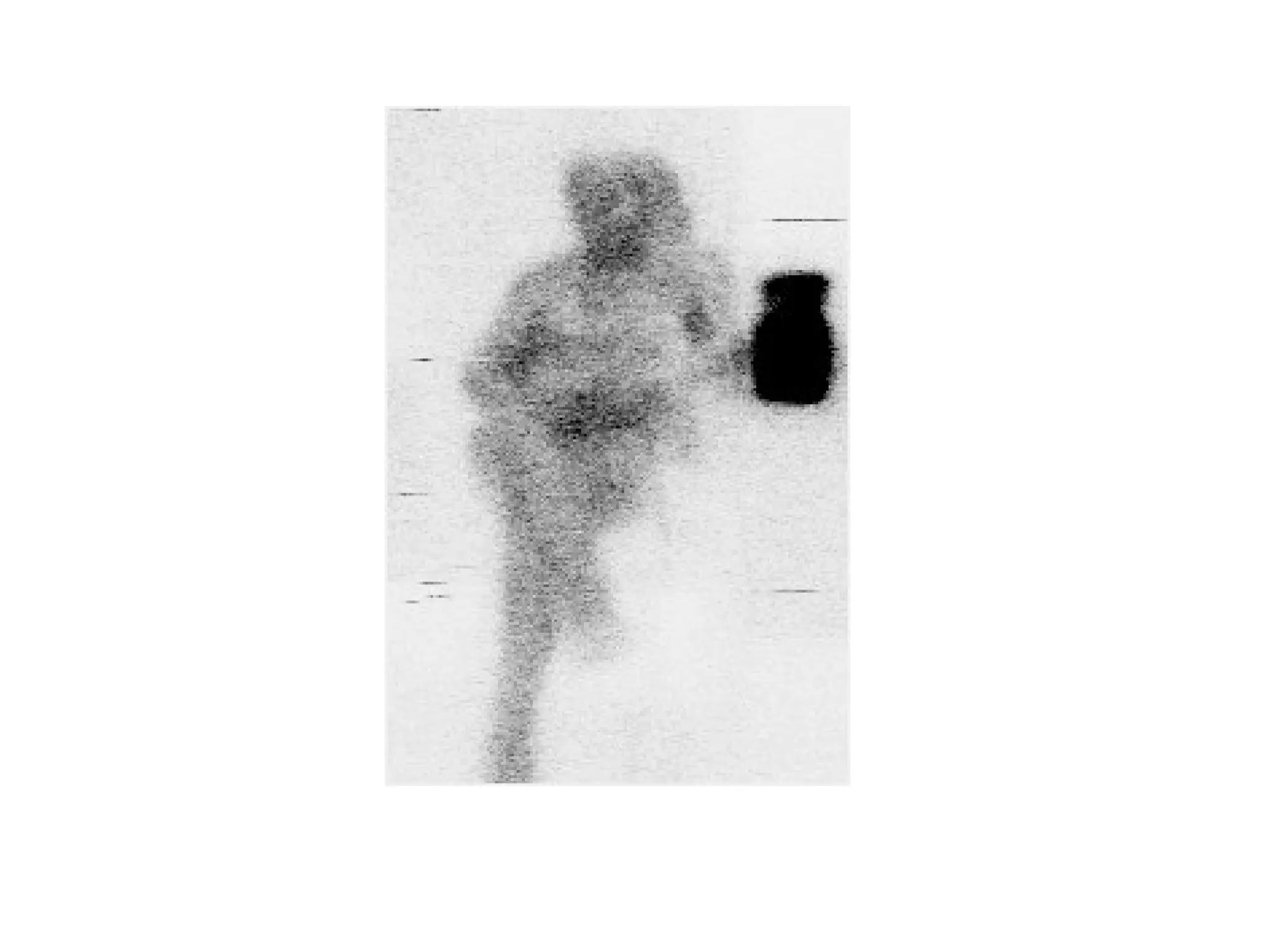 Passive Millimeter Wave Radiometric Imaging System Ppt