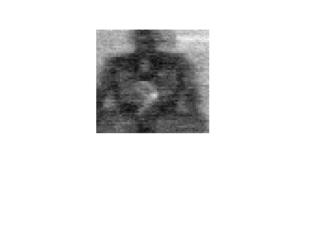 Passive Millimeter Wave Radiometric Imaging System Ppt