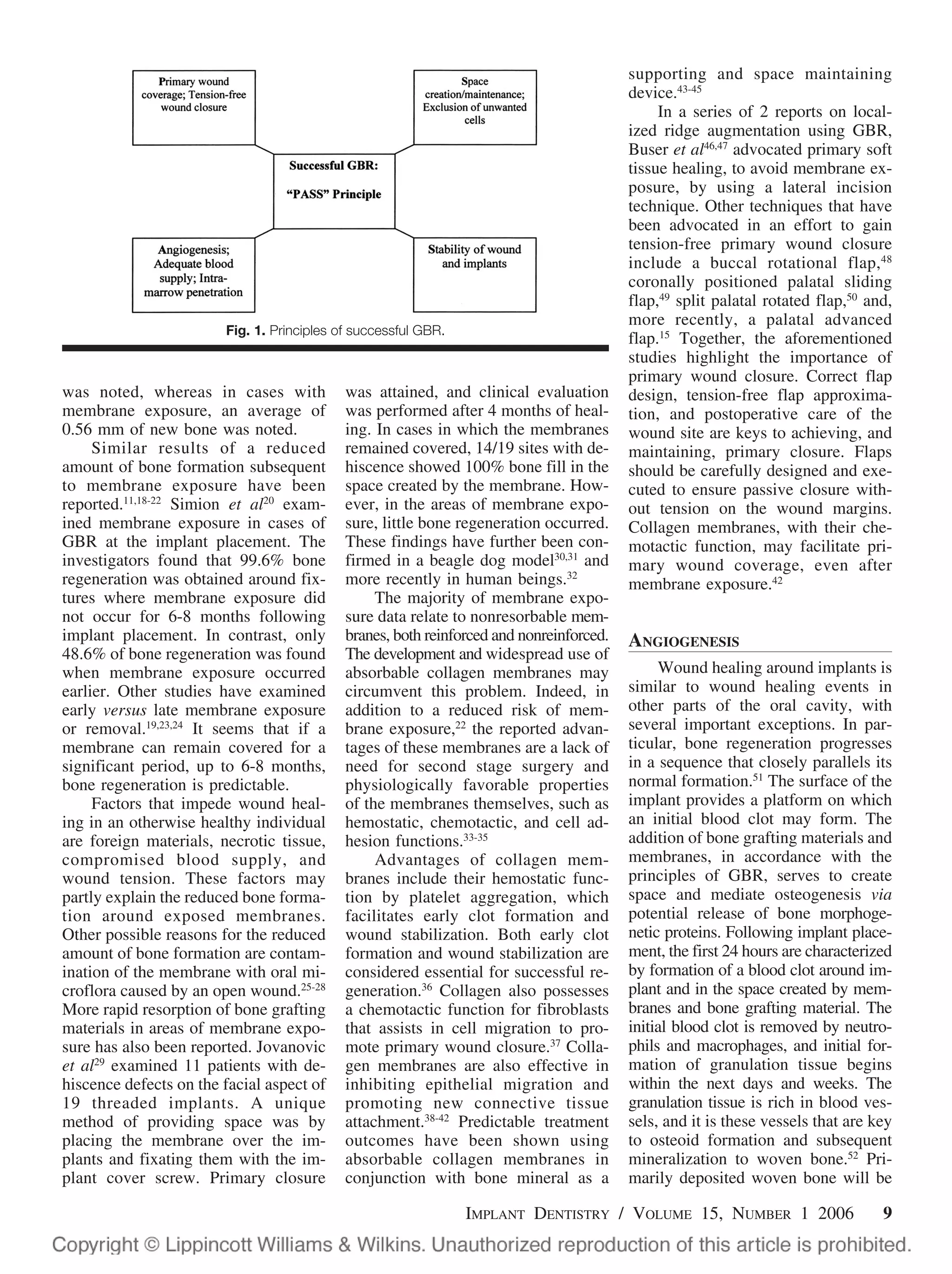 “PASS” Principles for Predictable Bone Regeneration | PDF