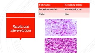 PAS STAIN.pptx