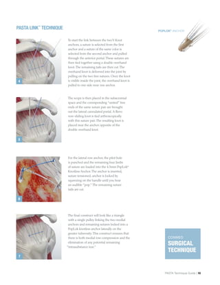 4 Techniques for Transtendinous PASTA Repair | PDF