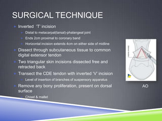 Pastern Arthrodesis | PPTX