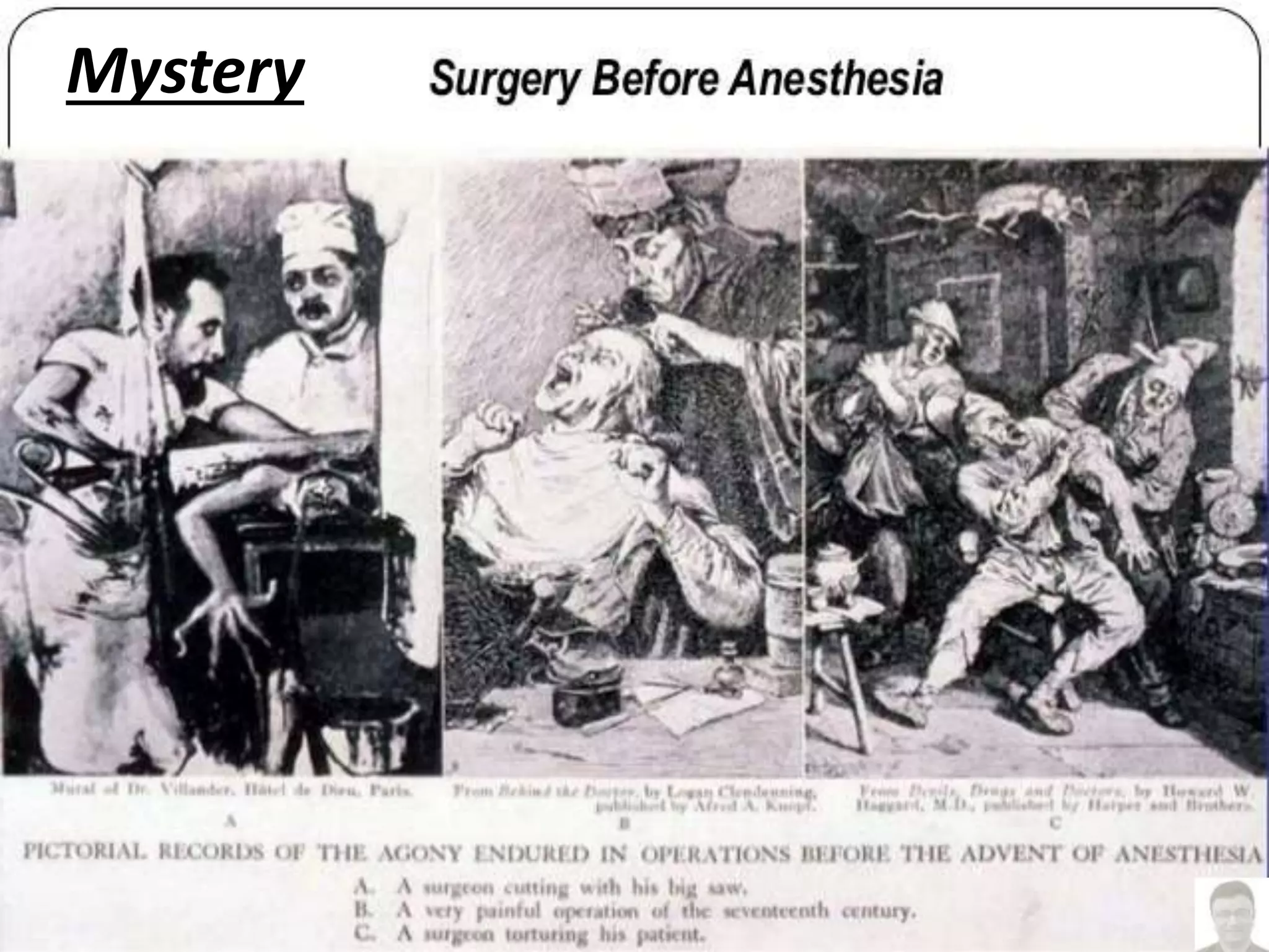 Past, present and future of anesthesia | PPTX
