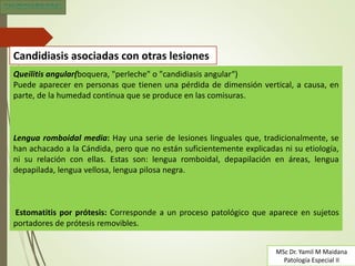 candidiasis oral | PPTX