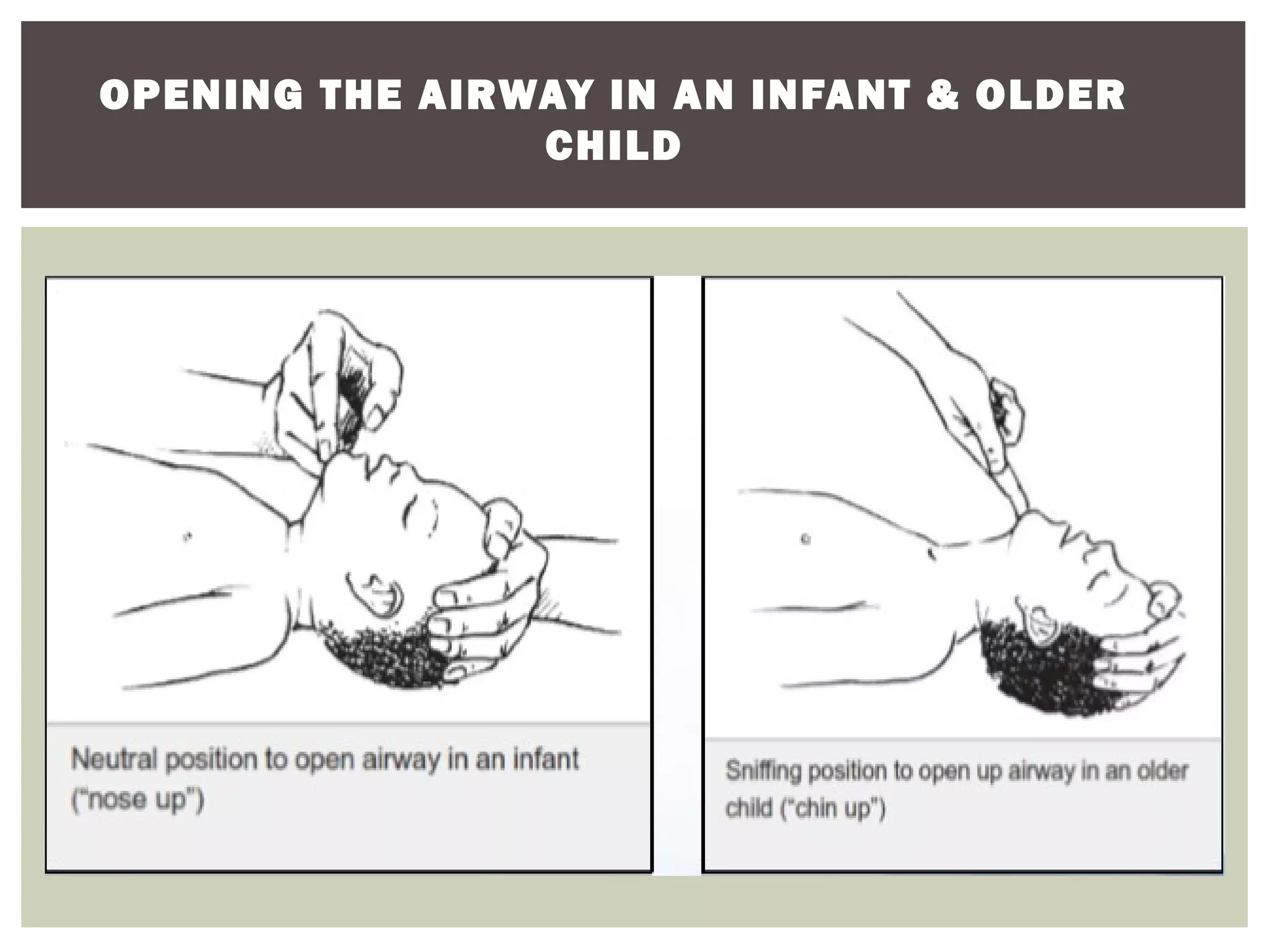 Pediatric assessment triangle | PPT