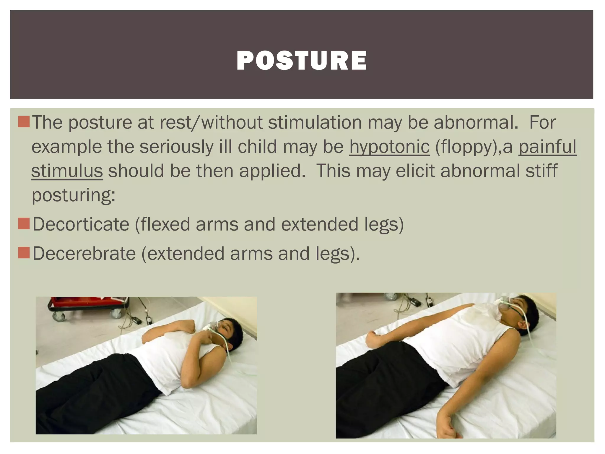 Pediatric assessment triangle | PPT