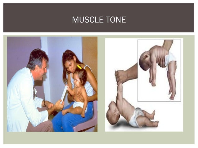 Pediatric assessment triangle | PPT | First Aid | Injuries