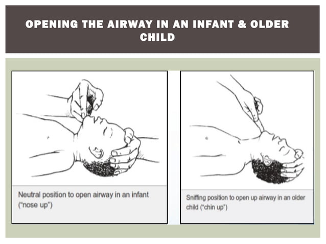 Pediatric assessment triangle | PPT | First Aid | Injuries