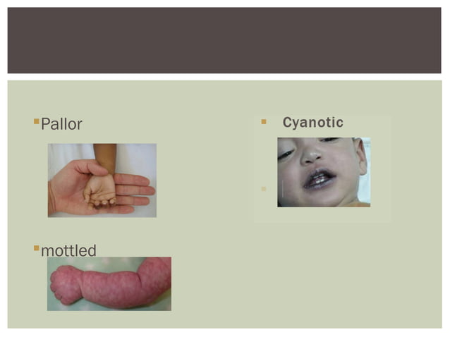 Pediatric assessment triangle | PPT | First Aid | Injuries