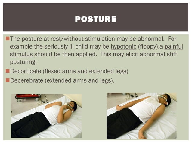 Pediatric assessment triangle | PPT | First Aid | Injuries