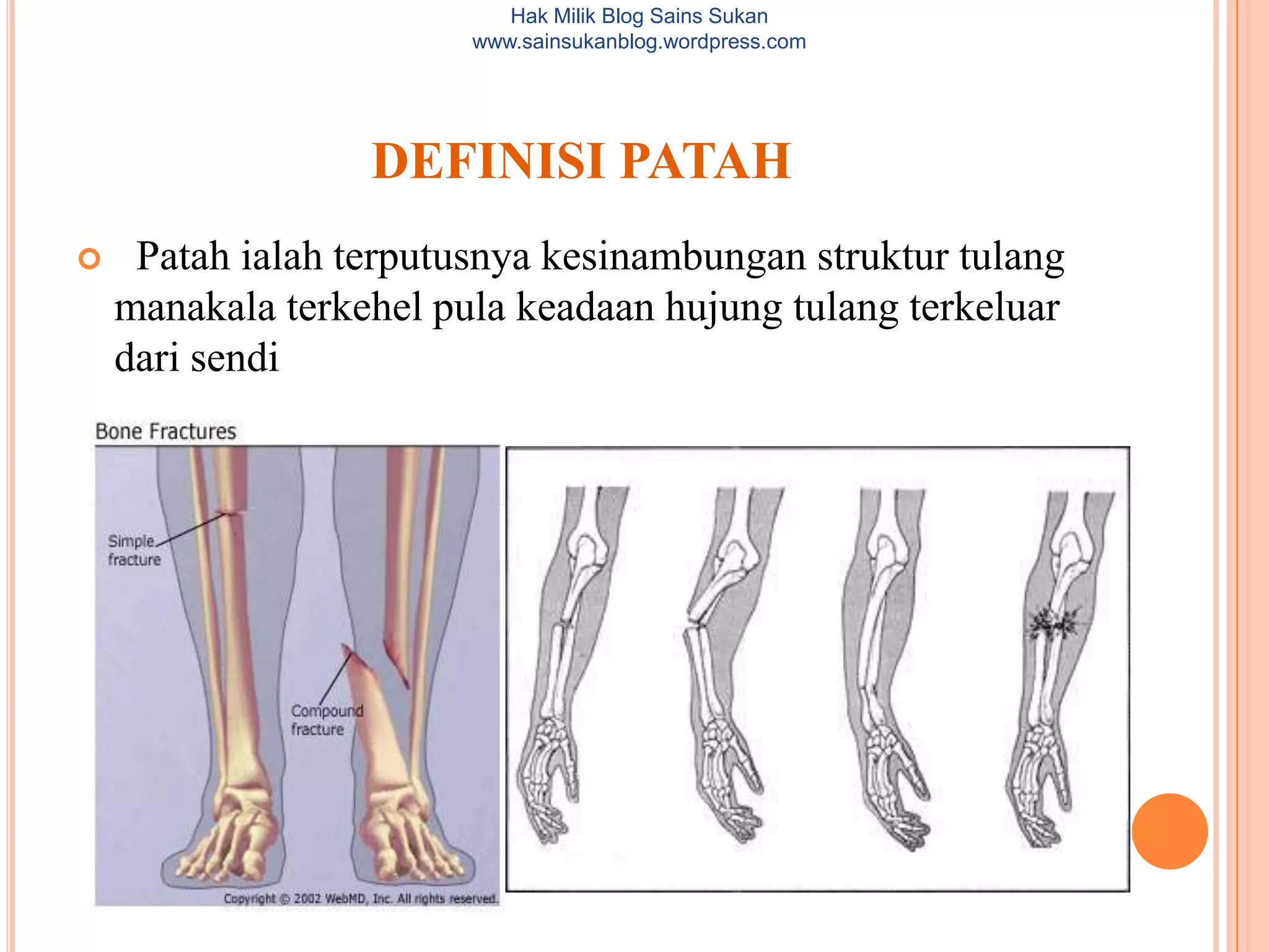 Patah dan terkehel | PPTX