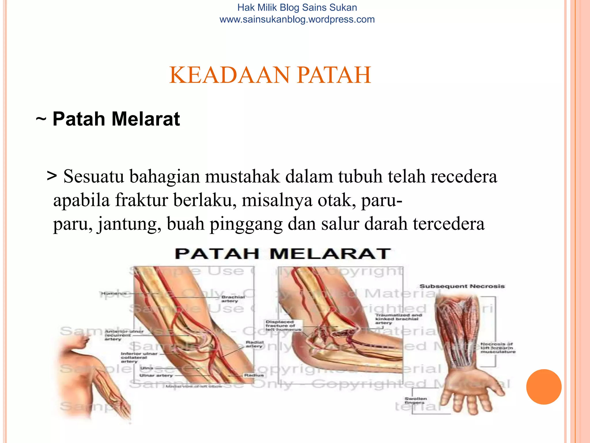 Patah dan terkehel | PPTX