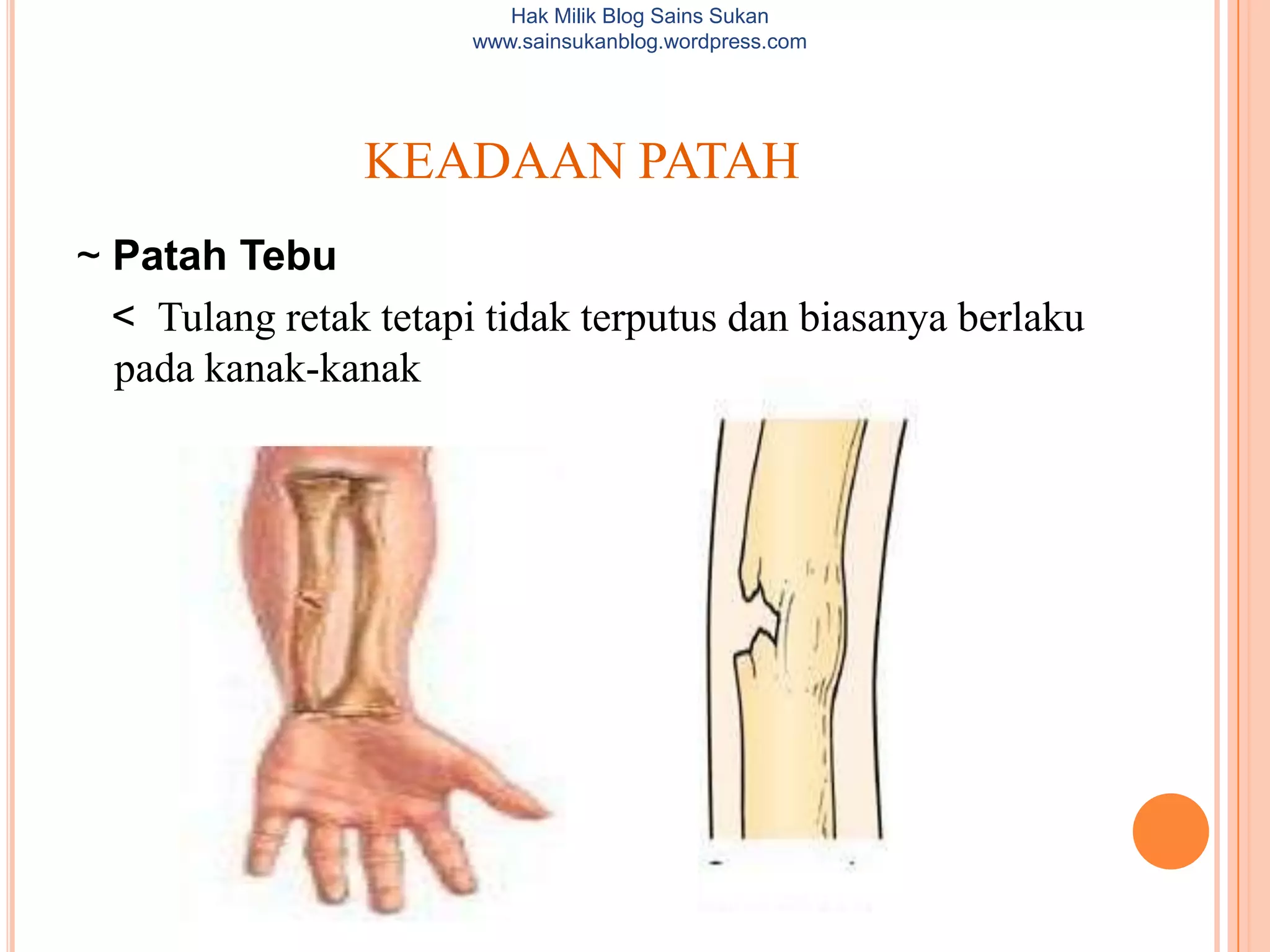 Patah dan terkehel | PPTX