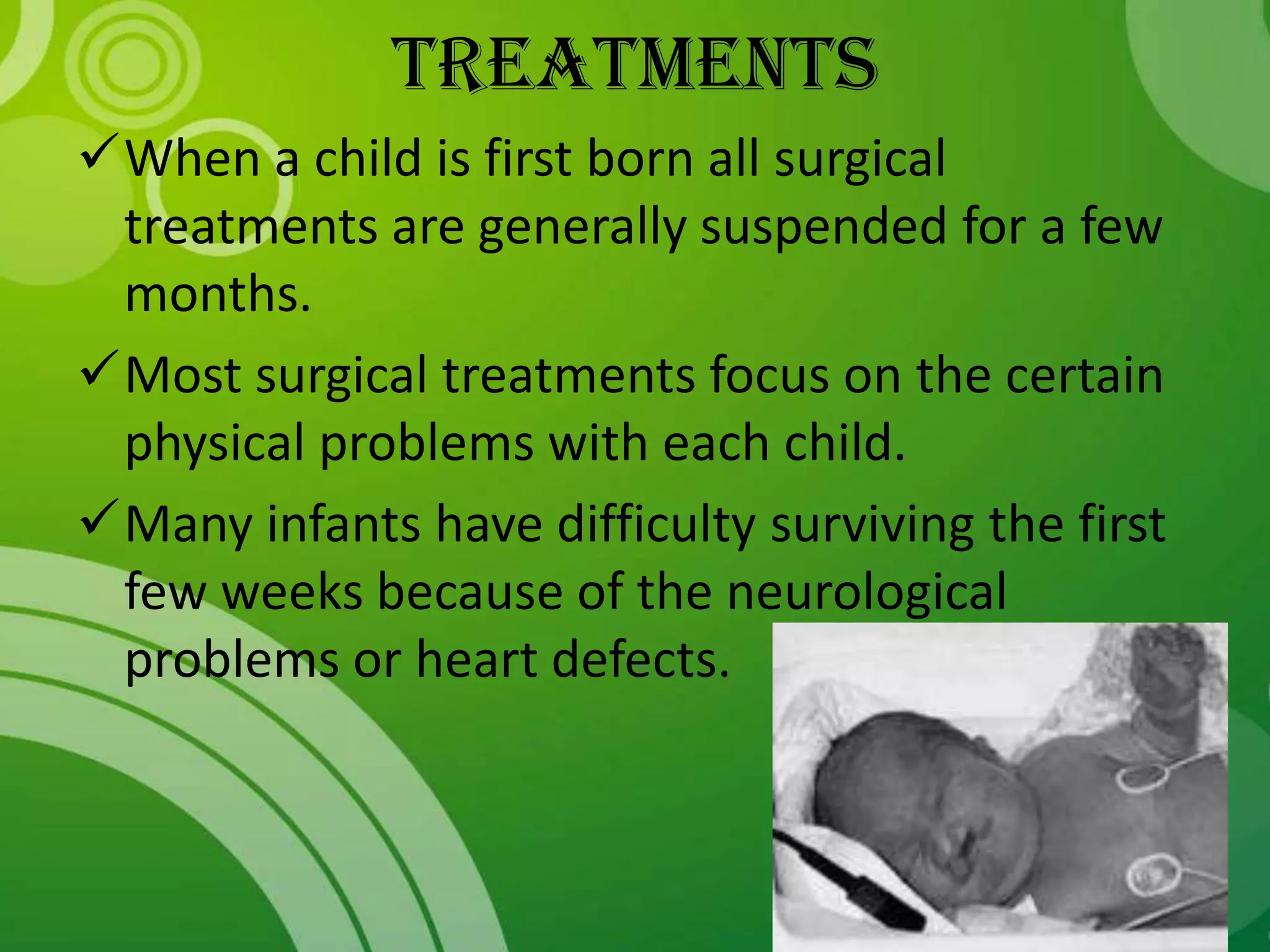 Patau Syndrome | PPTX