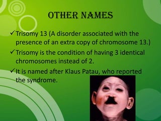 Patau Syndrome | PPTX