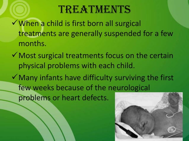 Patau Syndrome | PPT