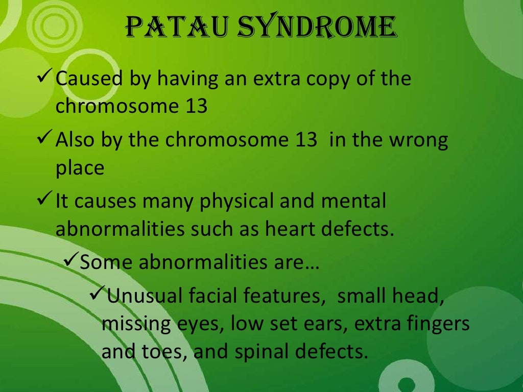 Patau Syndrome