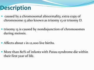Trisomy 13 (Patau syndrome)🎈 Descubra a emoção do jogo com plataforma ...