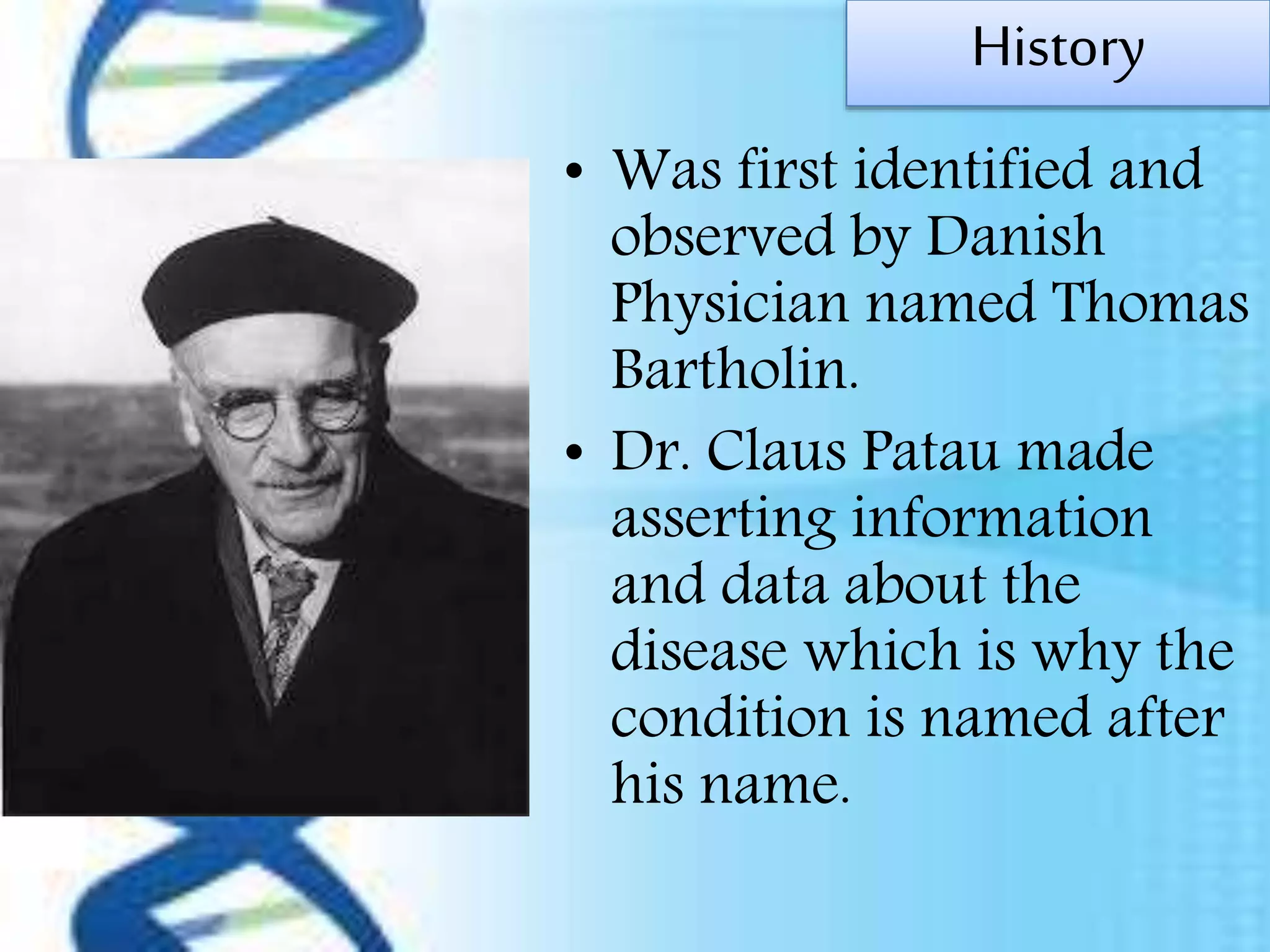 Patau Syndrome | PPTX