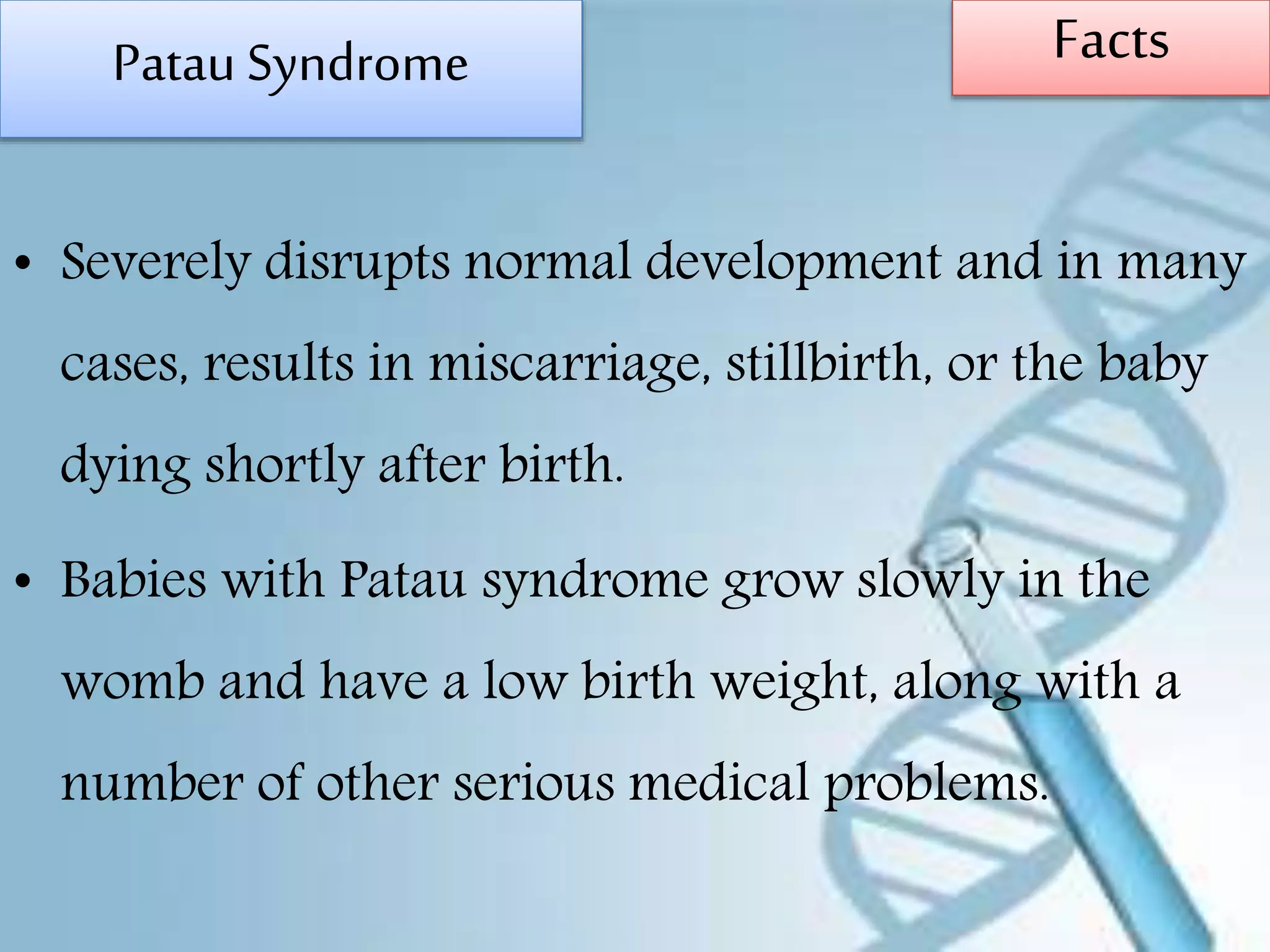 Patau Syndrome | PPTX