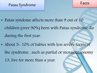 Patau Syndrome | PPTX