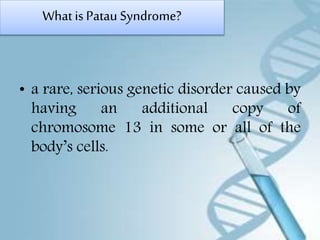 Patau Syndrome | PPTX