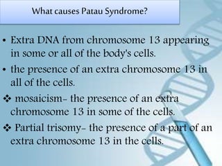 Patau Syndrome | PPTX
