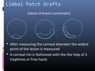 Patch Graft | PPT