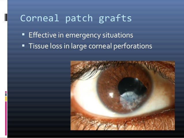 Tutoplast Patch Graft