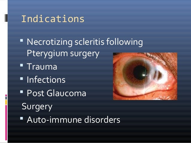 Tutoplast Patch Graft