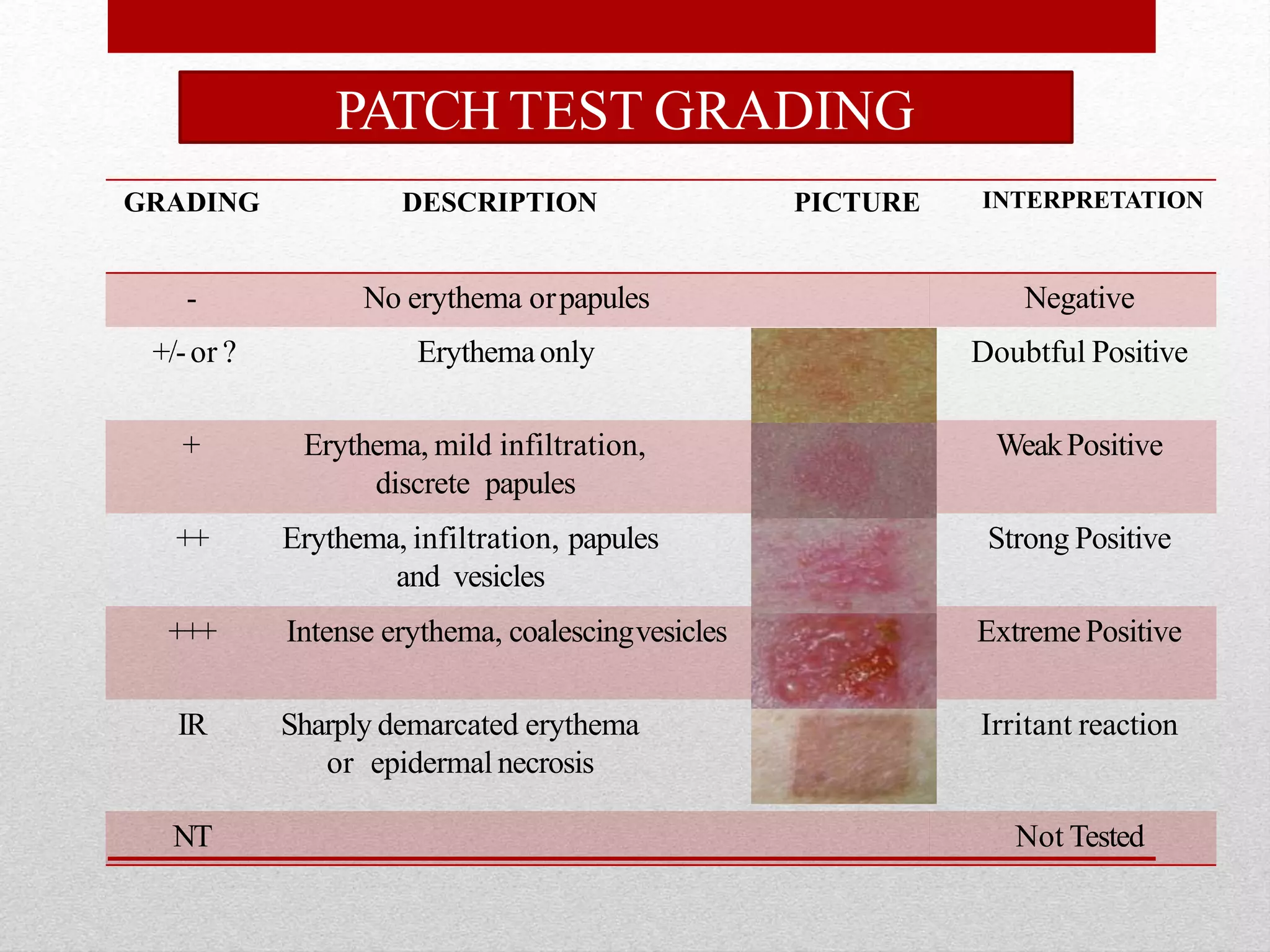 Patch test | PPTX