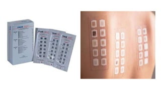 Patch test.pptx