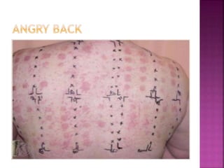 Patch test in dermatology | PPTX