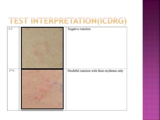 Patch test in dermatology | PPTX