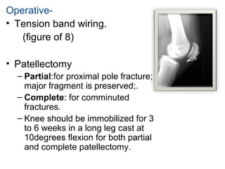 Patella fracture | PPT