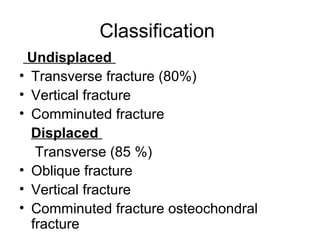 Patella Fracture Classification