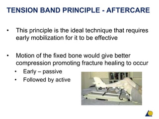 Patella and olecranon fractures | PPTX