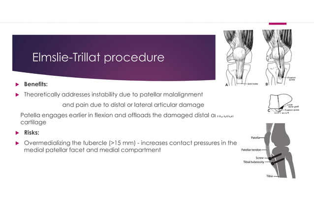 Patella Instability | PDF | Death, Injury, or Military Conflict ...