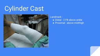 Cylinder Cast Patella