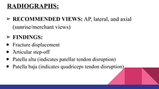 Patella Fractures by Dr Saleem Nasir.pptx
