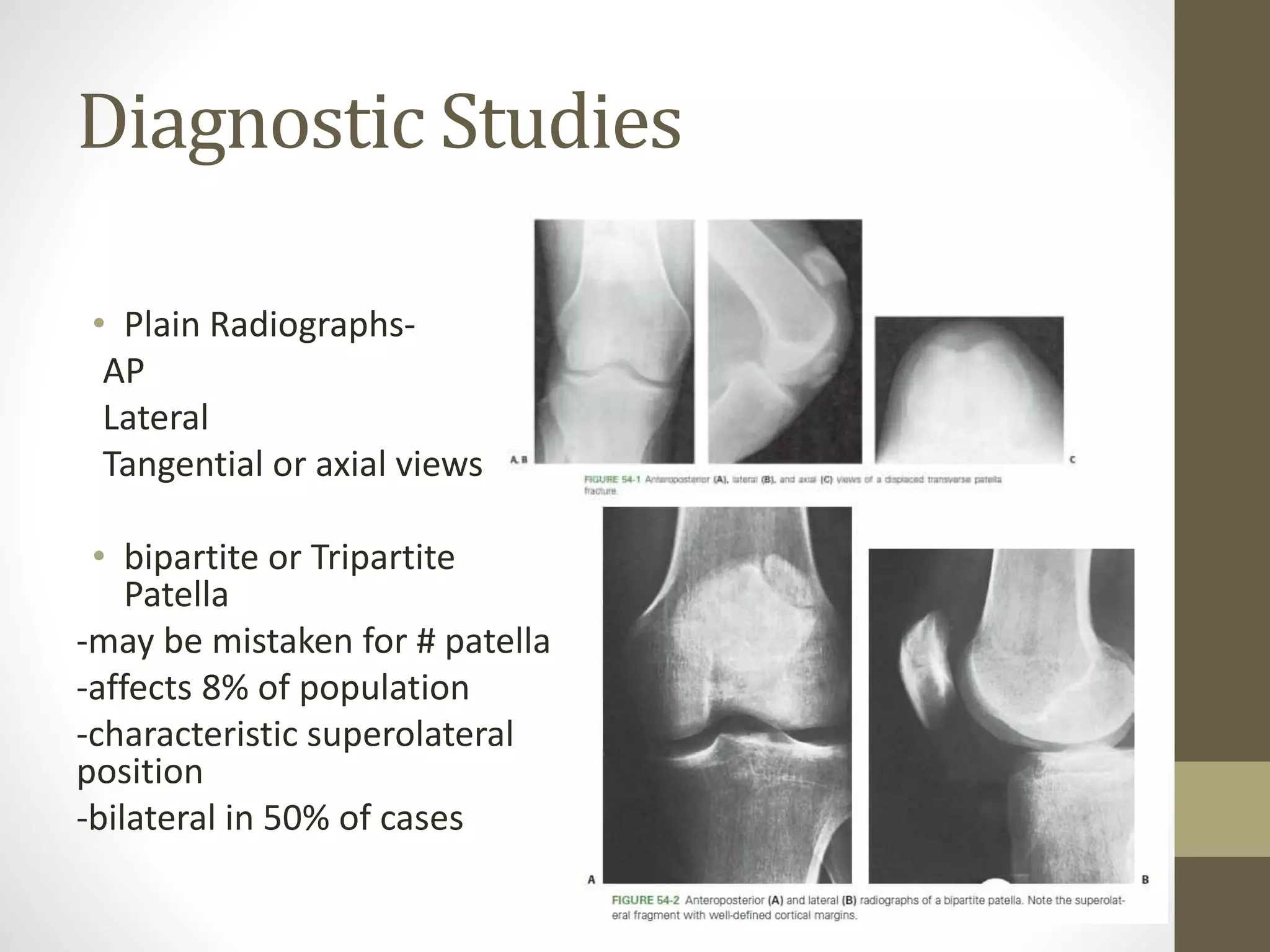 Patella fractures seminar mukul 11.06.2018